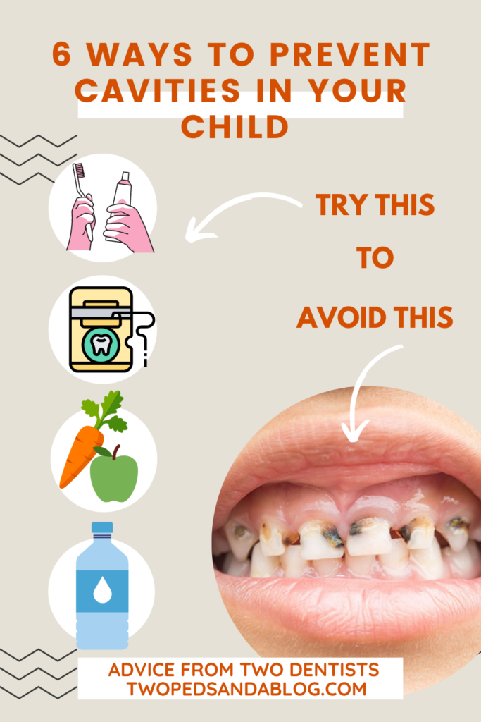 6 Simple Ways to Prevent Cavities in Your Kid's Teeth - Two Peds And A Blog